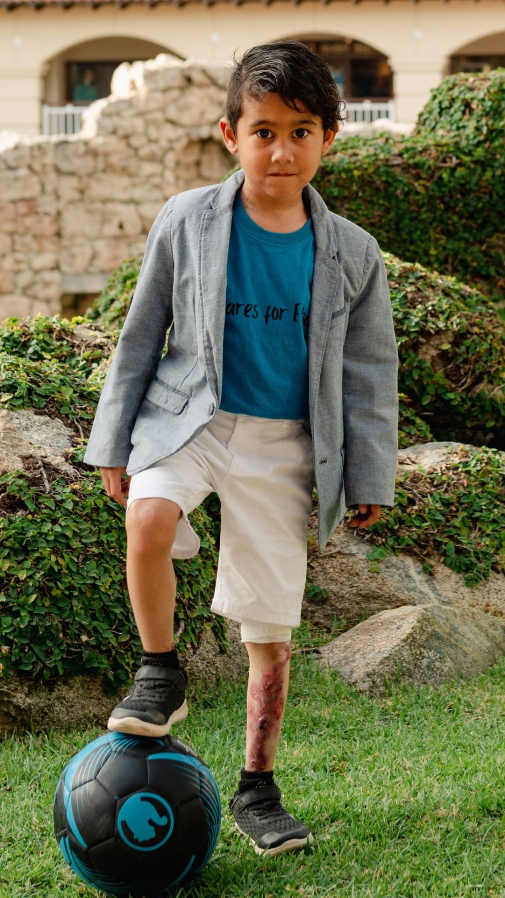 FIRST APPROVED REMEDY FOR PATIENTS WITH EPIDERMOLYSIS BULLOSA (EB)