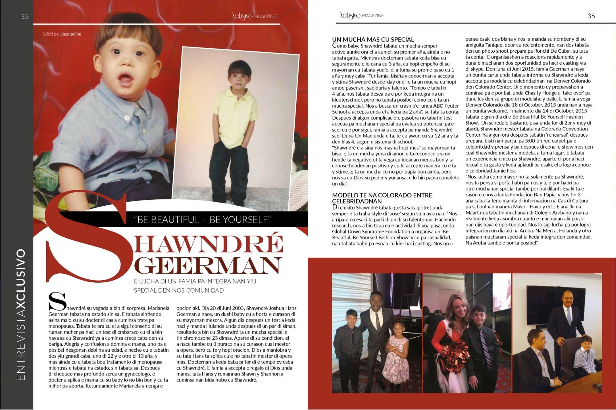 Shawndré Geerman; A model, athlete & true symbol of inclusion